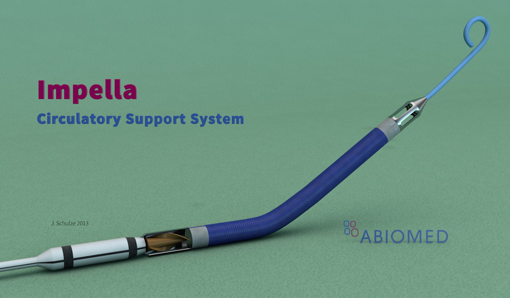 Impella | Herz-Lungen-Maschine